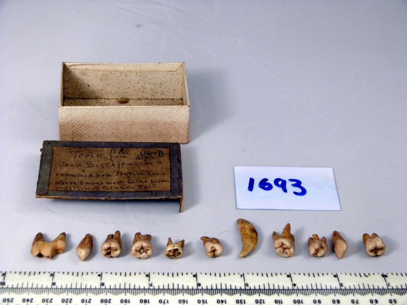Human teeth; Before 1719; 1693 | eHive