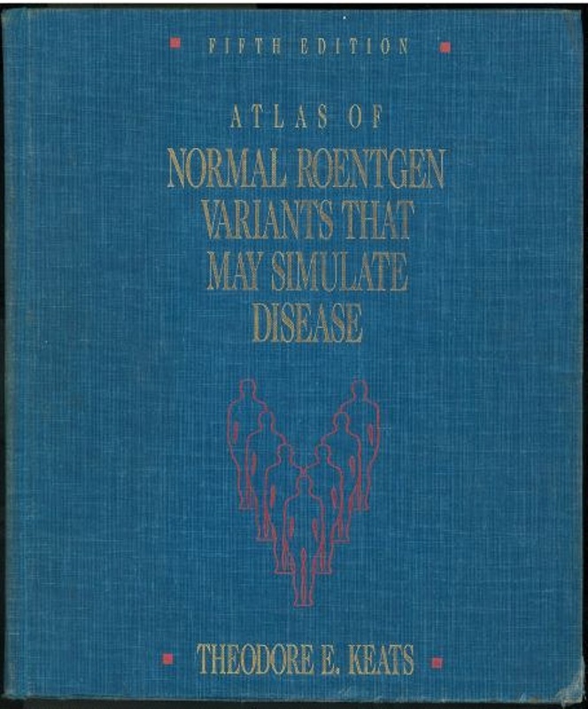 An atlas of normal roentgen variants that may simulate disease ...