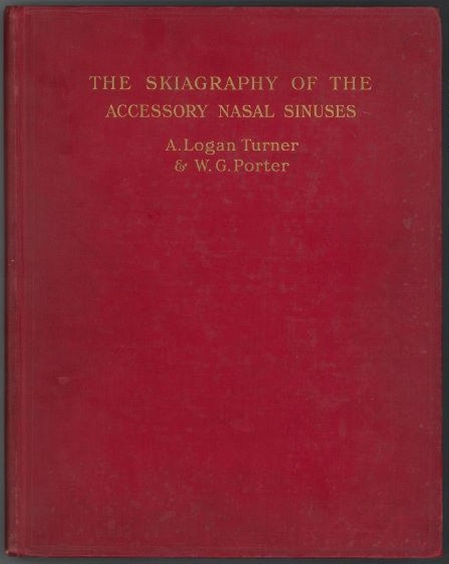 The skiagraphy of the accessory nasal sinuses / by A. Logan Turner and ...