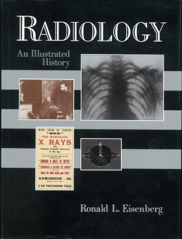 Radiology : an illustrated history / Ronald L. Eisenberg.; Eisenberg ...