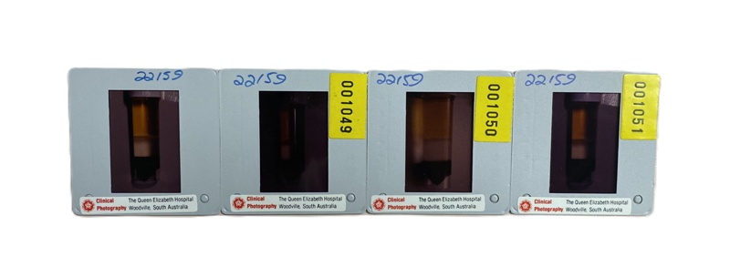 Equipment: Mononucleosis Cells in Test Tubes ; Clinical Photography ...