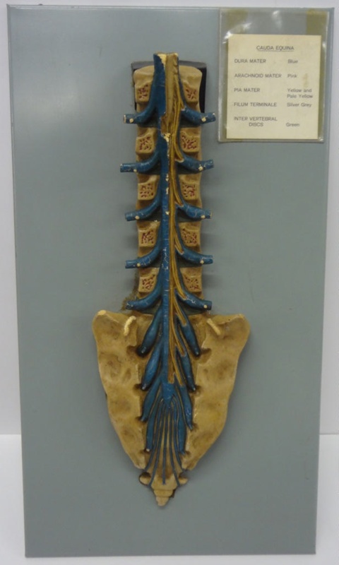 Equipment: Model of Cauda Equina; AR#9276 | eHive