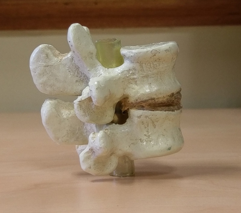 Equipment: Two articulated plaster vertebra; Ca 1960; AR#4428 | eHive
