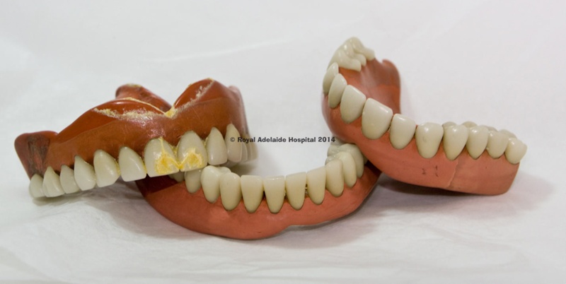 Instrument: Vulcanite Dentures; Ca 1940; AR#3314 | eHive
