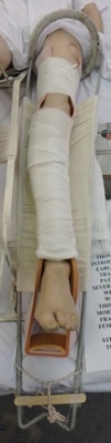 Equipment: Thomas Splint; AR#10328 | eHive