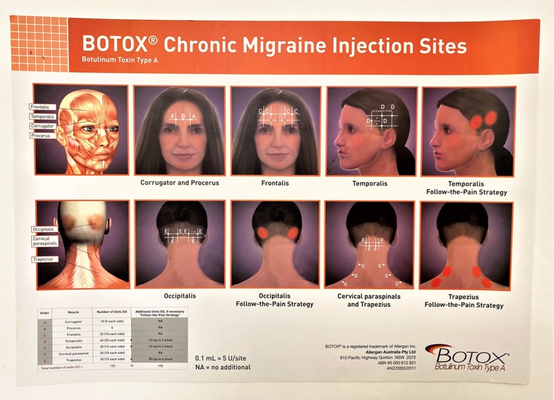 Poster: 2x BOTOX Chronic Migraine Injection Sites ; 2011 ?; AR#17159 ...