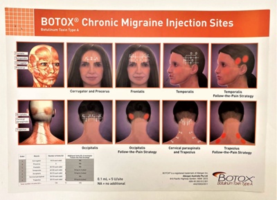 Poster: 2x BOTOX Chronic Migraine Injection Sites ; 2011 ?; AR#17159 ...