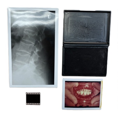 Multimedia: X-Ray, Dental Photograph, Reprography Request Negative and ...