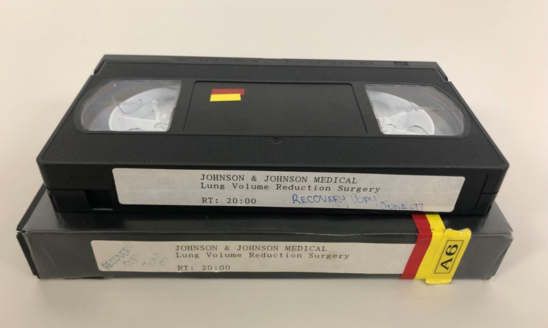 Multimedia: VHS Tape - A Videoscopic Approach to Lung Volume Reduction ...