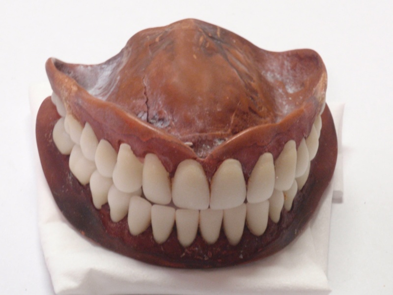 Equipment: Vulcanite Dentures; Ca 1930; AR#3276 | eHive