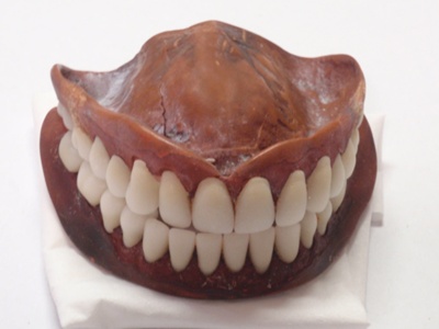 Equipment: Vulcanite Dentures; Ca 1930; AR#3276 | eHive