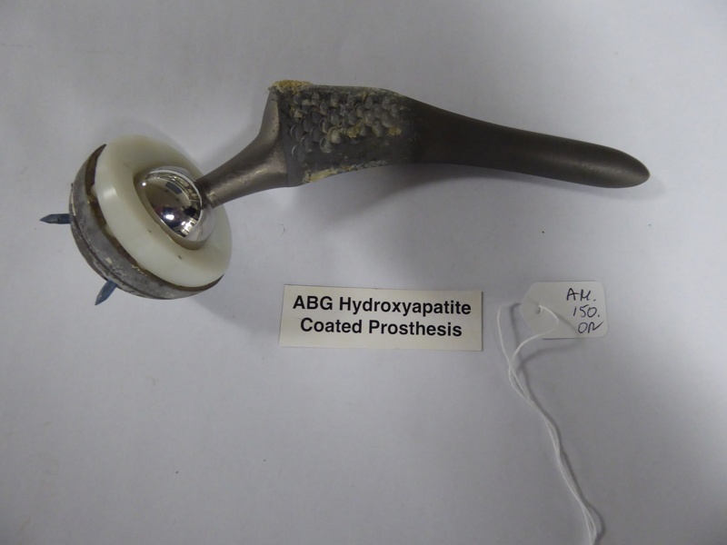 ABG Hydroxyapatite Coated Hip Prosthesis; AM.150.OR | eHive