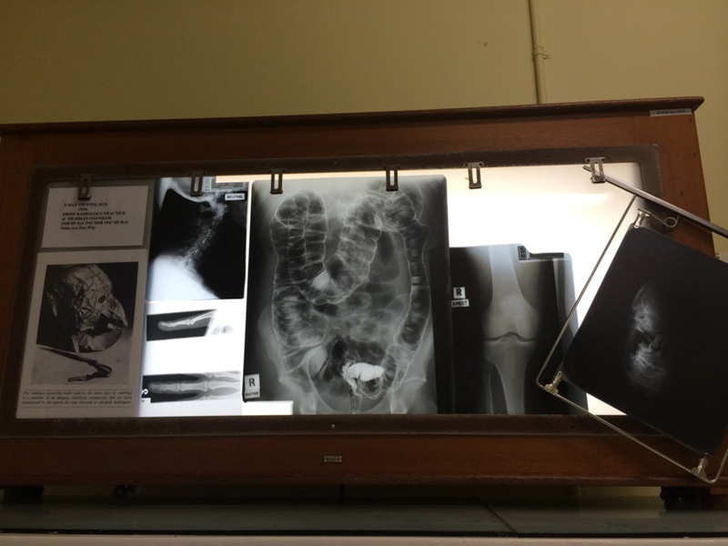 X Ray viewing Box 1950's from Radiology practice of Dr Brian Oxenham ...