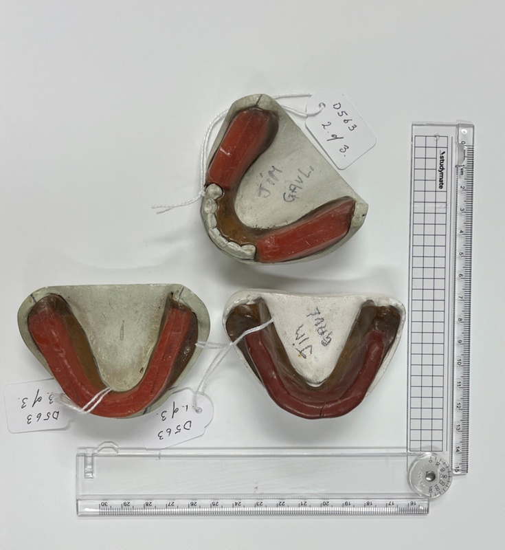 Wax Bite Registration Rims (Contour Models); Jim Gaul (Dental ...