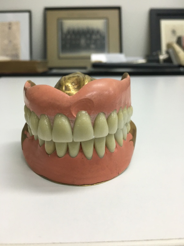 1912 Gold-based vulcanite dentures; 1912; D345 | eHive